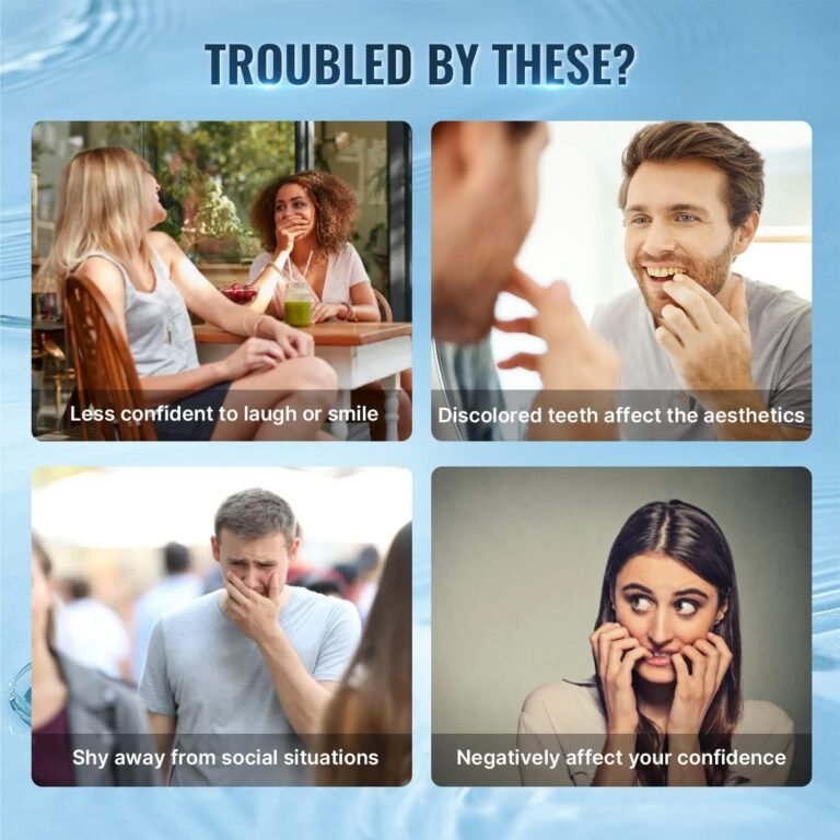 Whitebite Pro Teeth Whitening Kit Review - Health Wellbe